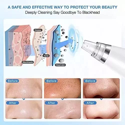 Blackhead Remover Pore Vacuum,Upgraded Facial Pore Cleaner,Electric Acne Whitehead Extractor Tool,USB Rechargeable Blackhead Vacuum Kit for Women & Men