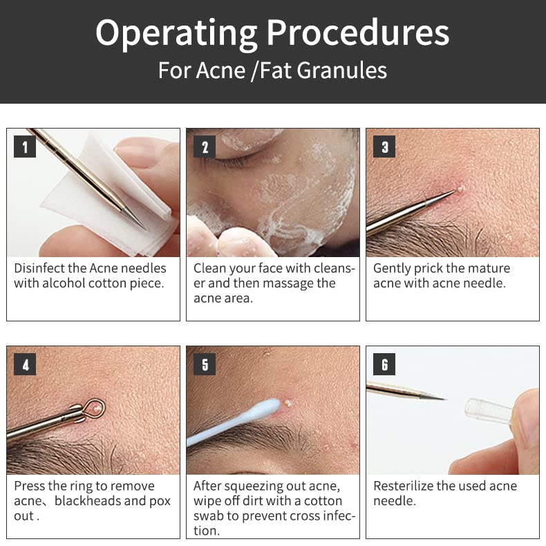 Blackhead Remover Tools,2024 Newest 10 PCS Acne Needles,GERY Whitehead removal Extractor tools,Pimple Popper Tool Kit, Professional Stainless Pimple Acne Blemish Removal Tools Set with Leather package