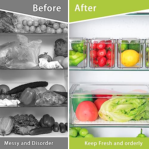 Moretoes Fridge Organizer, 5pcs, Clear Refrigerator Organizer with Lid, Bins Set, Stackable, BPA-Free, Fruit Storage Containers, Plastic Pantry Organizer and Storage