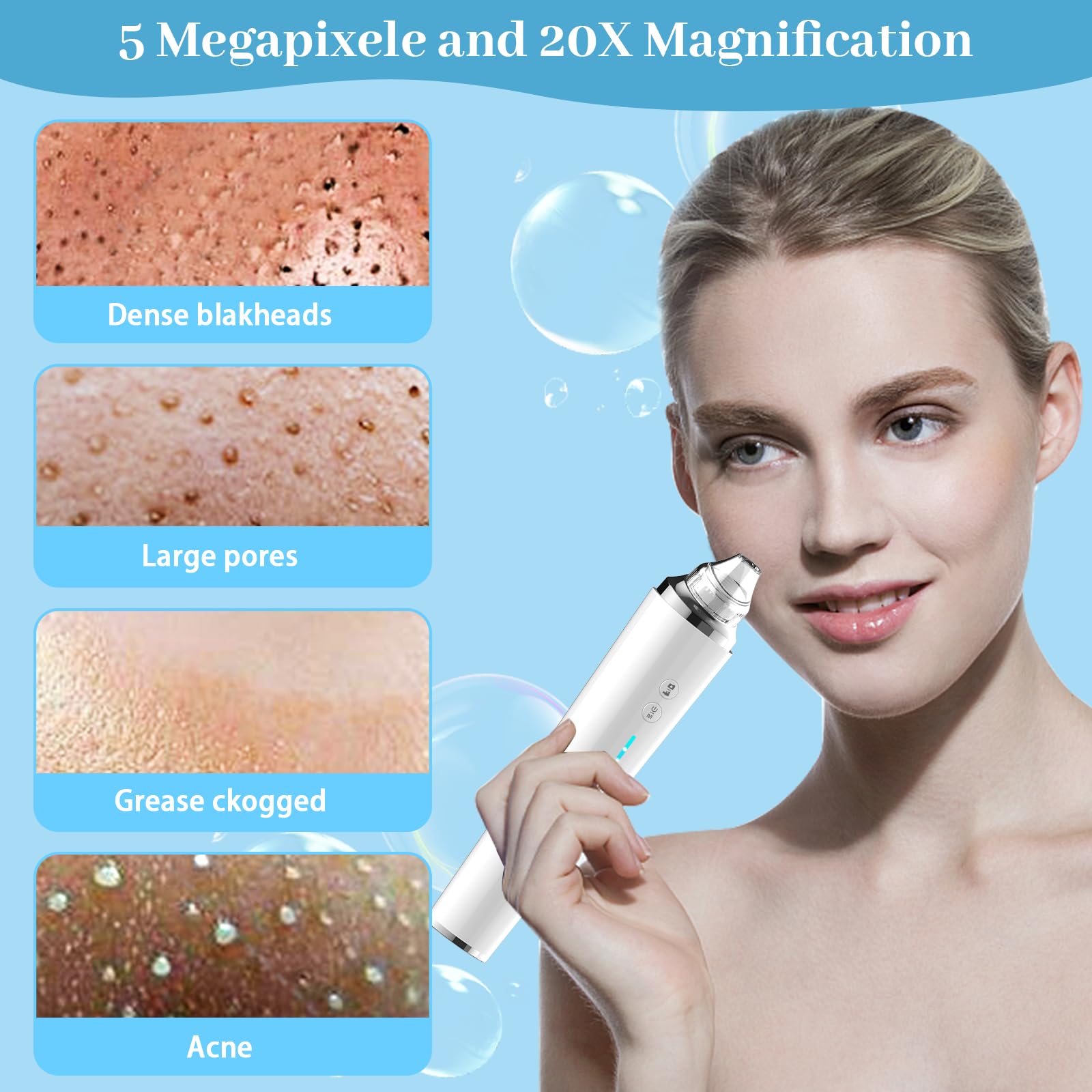 Blackhead Remover Pore Vacuum with Camera, Black Head Remover Suctioner 3 Suction Power & 6 Probes, WiFi Real-Time Skin Screen,Upgraded Pimple Vacuum Acne Comedone Extractor