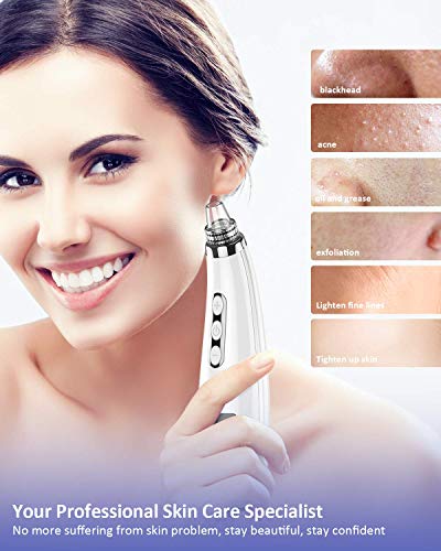 Blackhead Remover Pore Vacuum - Upgraded Strong Suction Electric Pore Cleanser Beauty Device for Deep Facial Skin Cleaning - 5 Adjustable Suction, 6 Different Replacement Probes, USB Rechargeable