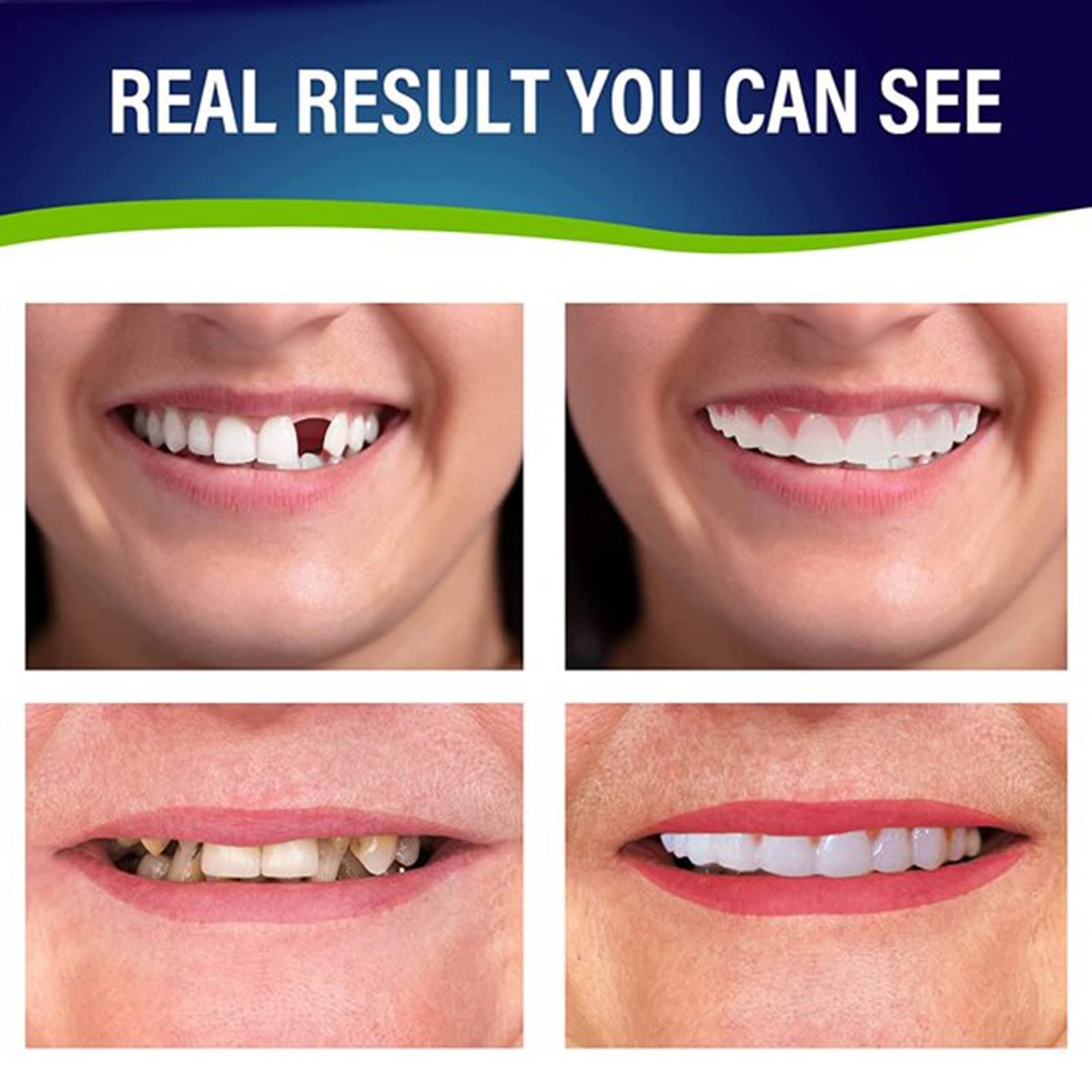 BEGUT Fake Teeth, Cosmetic Denture Veneers for Upper and Lower Jaw, Natural Shade Fake Veneer for Temporary Fix Confident Smile - White