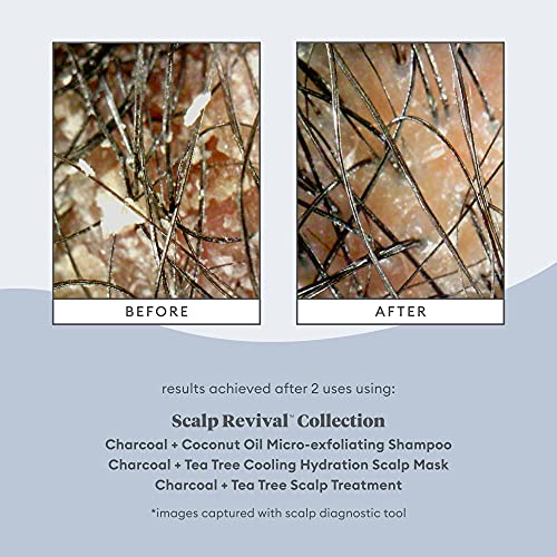 Briogeo Scalp Revival™ Dandruff Relief and Scalp Soothing Set