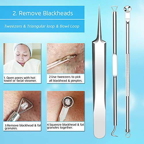 Best Blackhead Remover, Blackheads Blemish Removing, Acne Whitehead Removal Kit, Pimple Comedone Extractor Tool, Popper Pimples Treatment, with Tweezers, Risk Free for Face Forehead Nose