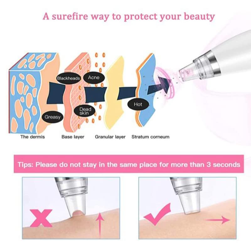 Blackhead Remover Pore Vacuum,Upgraded Facial Pore Cleaner,Electric Acne Whitehead Extractor Tool,USB Rechargeable Blackhead Vacuum Kit for Women & Men