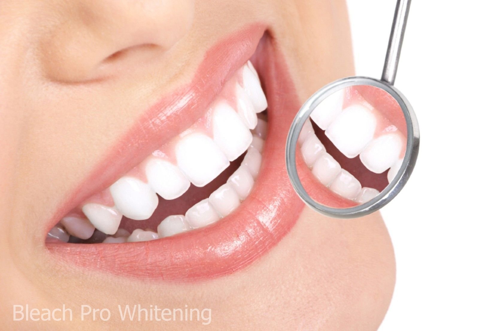 Teeth Whitening Gel 10% Carbamide Peroxide Tooth Bleaching Dispensers 10 pcs