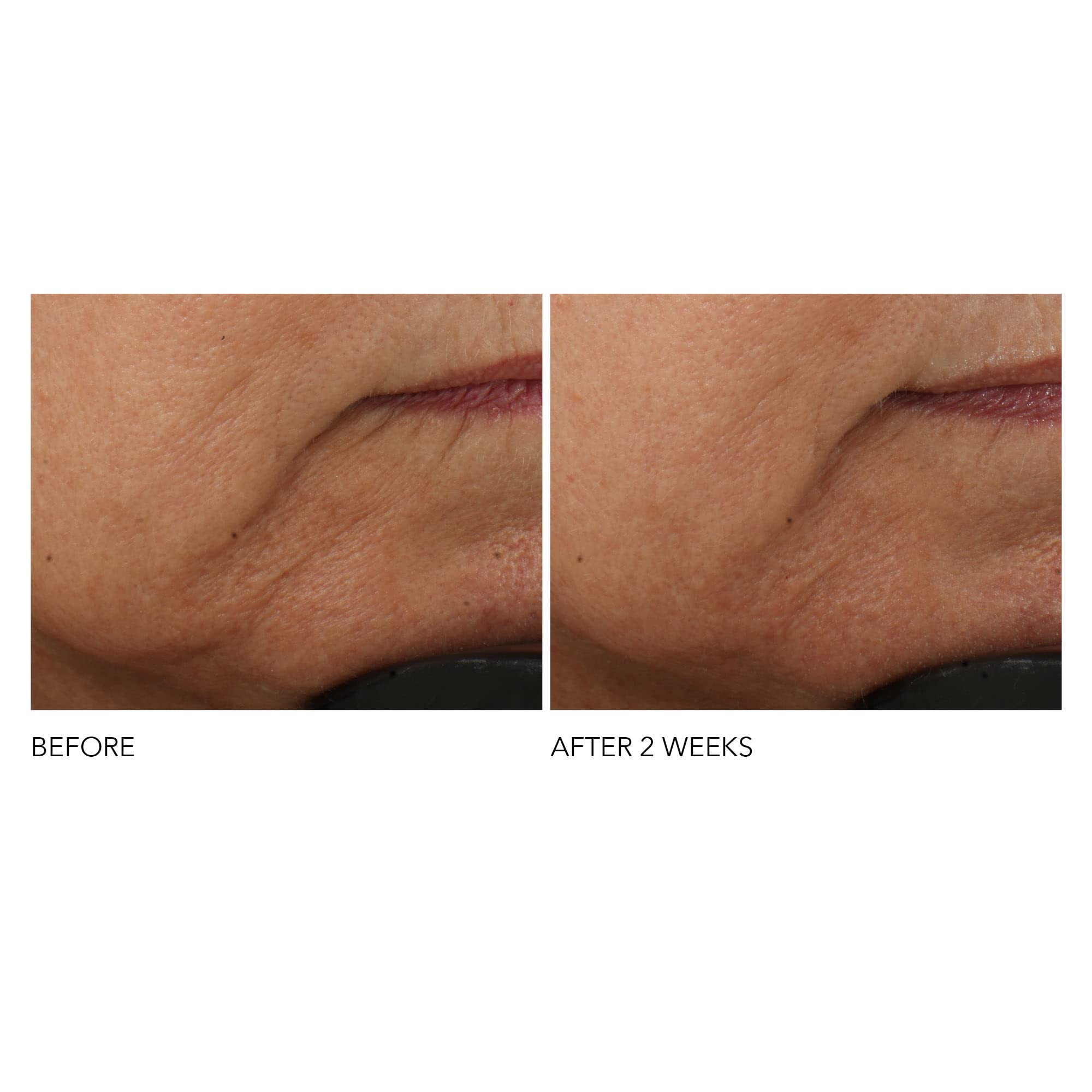 Dr Dennis Gross Advanced Retinol + Ferulic Intense Wrinkle Cream | Intensely Hydrating to Visibly Transform Skin and Repair the Moisture Barrier | 2 oz