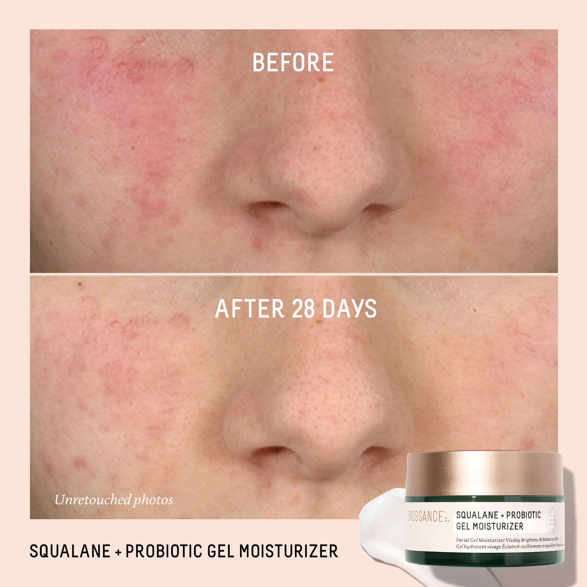 Biossance Squalane + Probiotic Gel Moisturizer. Extra Gentle Formula to Calm Skin with Redness or Rosacea, Reduce Pore Size Appearance and Restore Radiance (1.6 ounces)