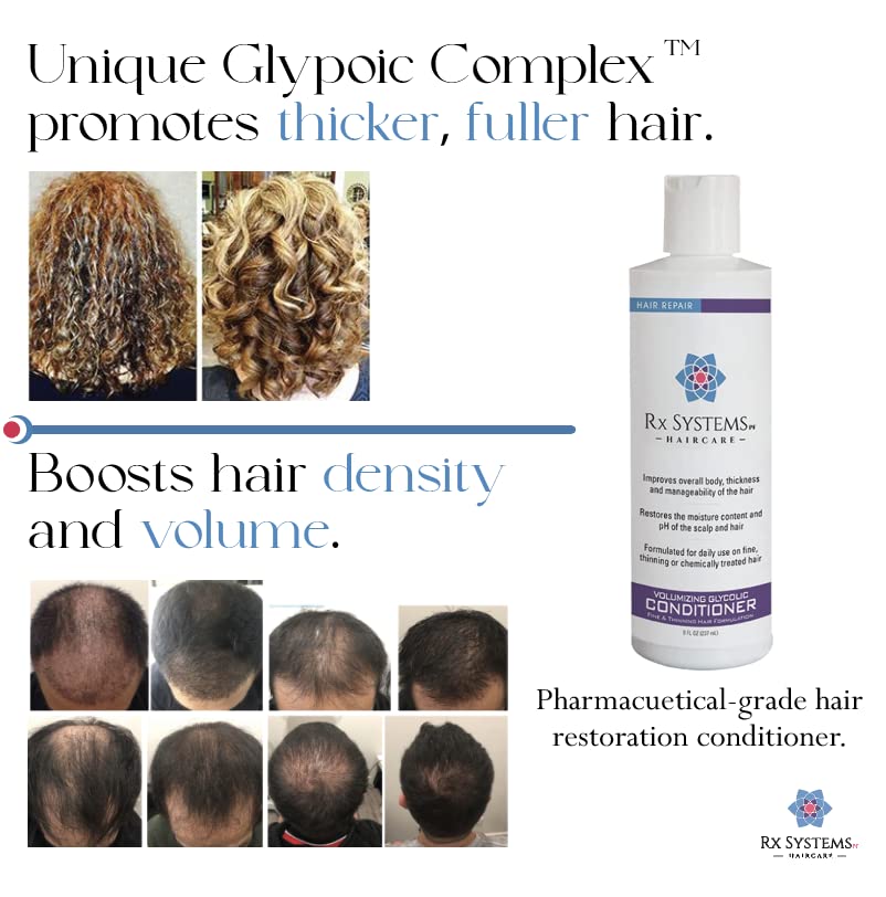 Rx Systems Pharmacy Grade Hair Growth Conditioner For Men And Women From Stops Thinning While Strengthening Vitality and Thickening Hair | pH Balanced | Treats Hair Loss