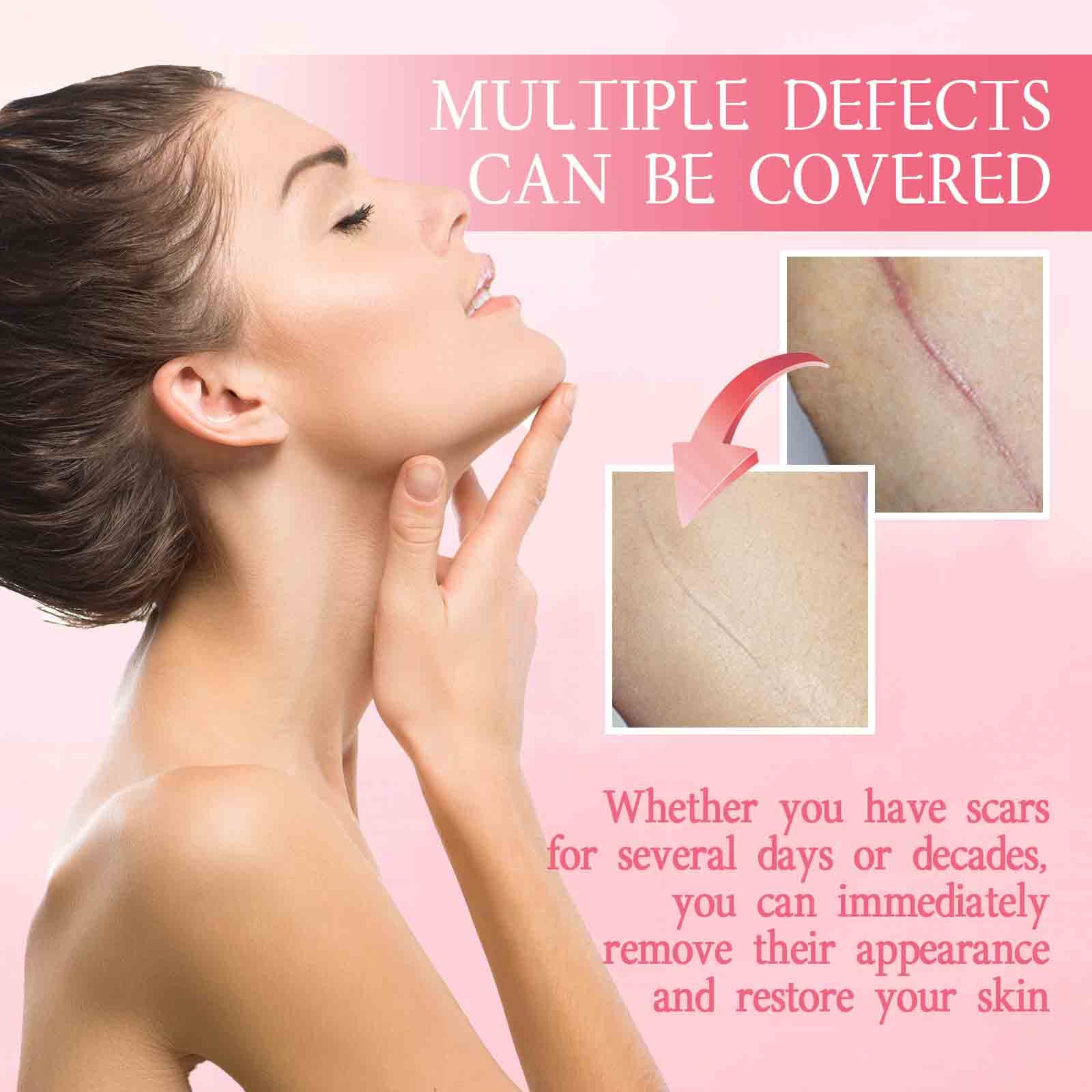 BodyBlendz Body Makeup Waterproof Foundation, Leg And Body Makeup Waterproof Foundation Covers Up Scar Blemishes Spots, Foundation With High Coverage, Long-Lasting, Evens Skin Tone (1PC)