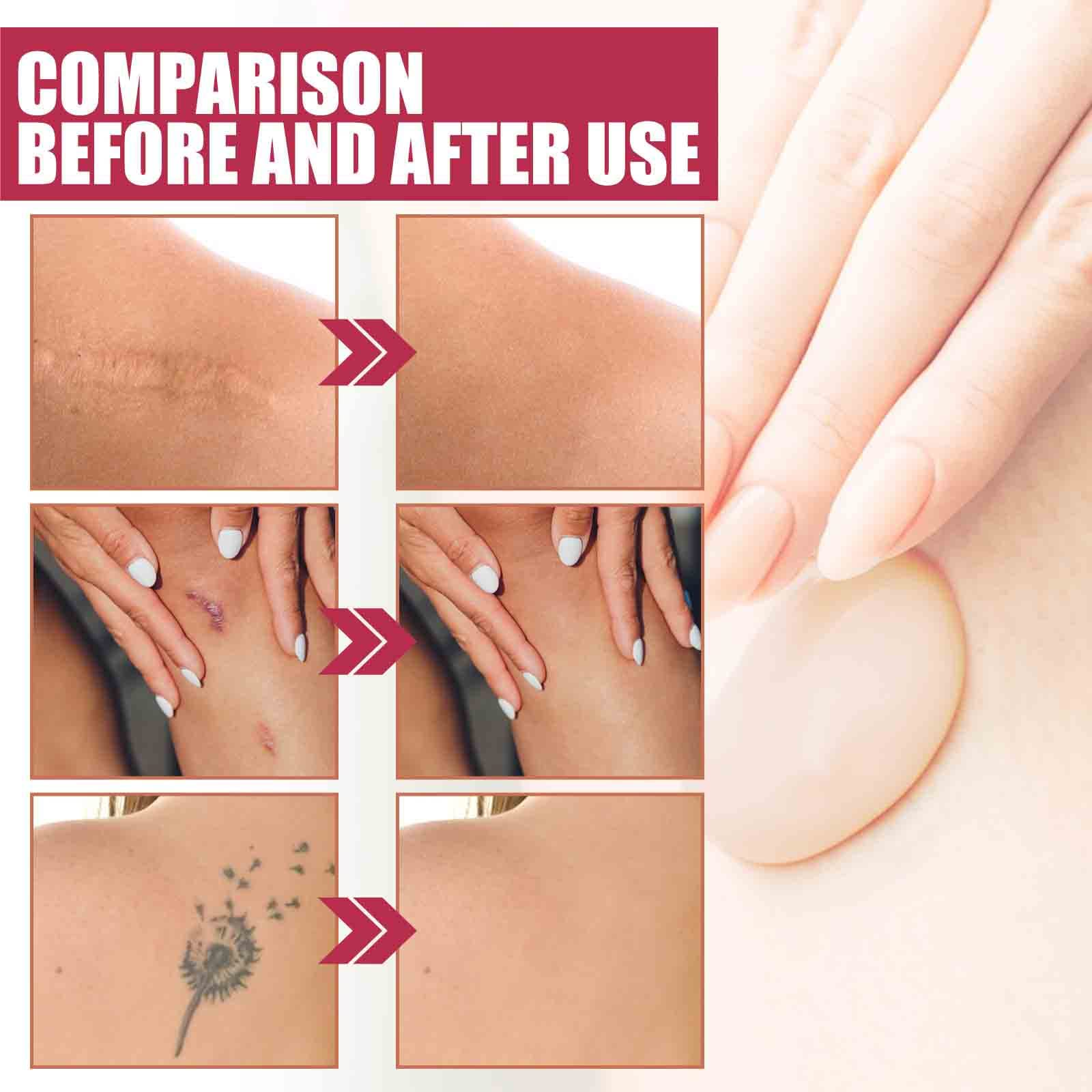 Body Makeup Foundation - Waterproof Leg And Body Makeup for Tattoo Cover Up, Scar Blemishes Spots Hide, Foundation for Legs with a Smooth, Even Tone Finish, 3.4 Fl. Oz (1PC)