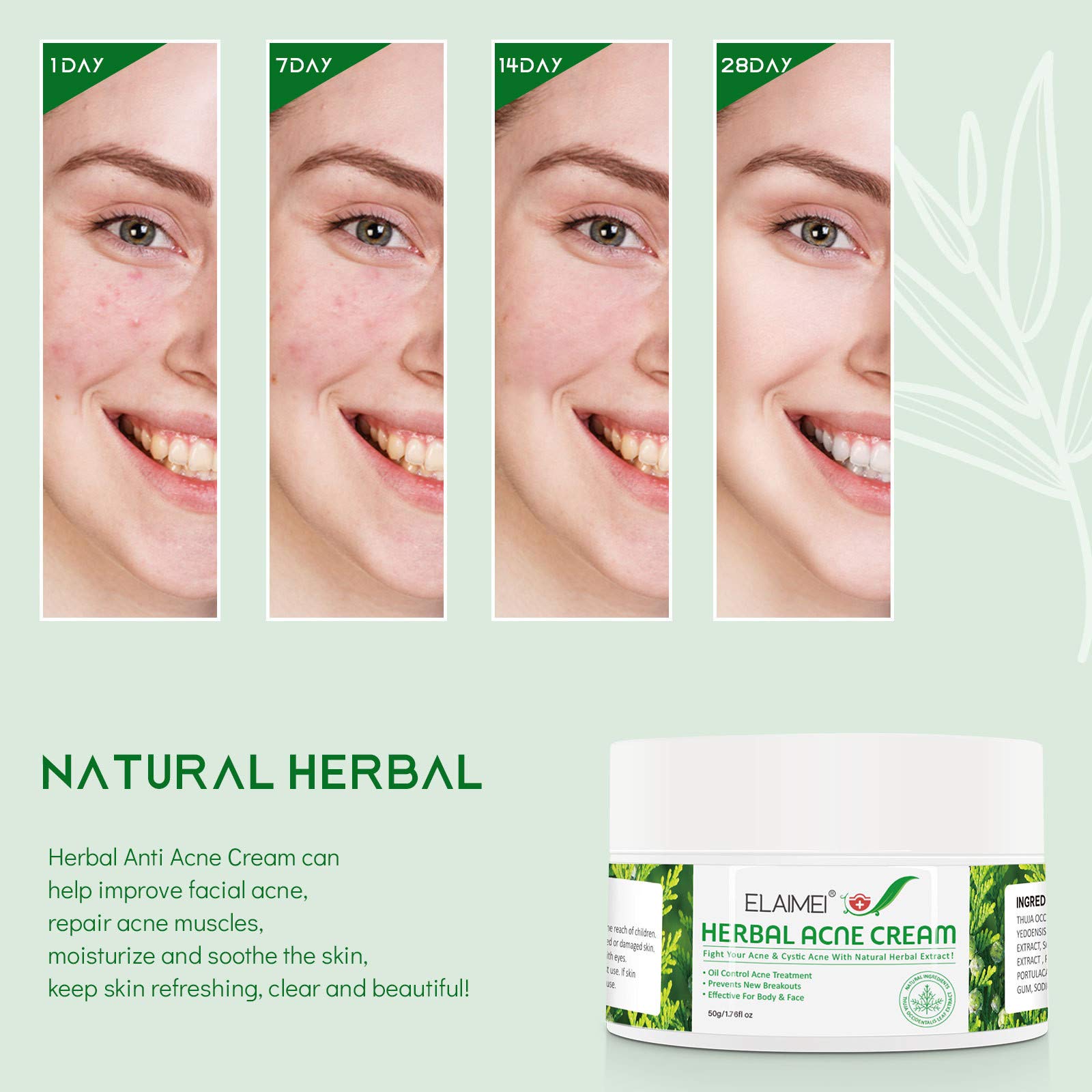 Closed Mouth Improve Herbal Skin Moisturize Personal Skin Care TGw305 (Multicolor, One Size)