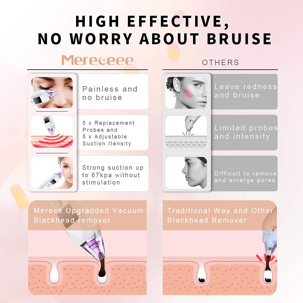 Blackhead Remover Vacuum Pore Cleaner - Merece Upgraded Black Head Vacuum Electric Blackhead Comedone Extractor Tool USB Rechargeable Face Acne Whitehead Removal Treatment with 3 Skin Care Light