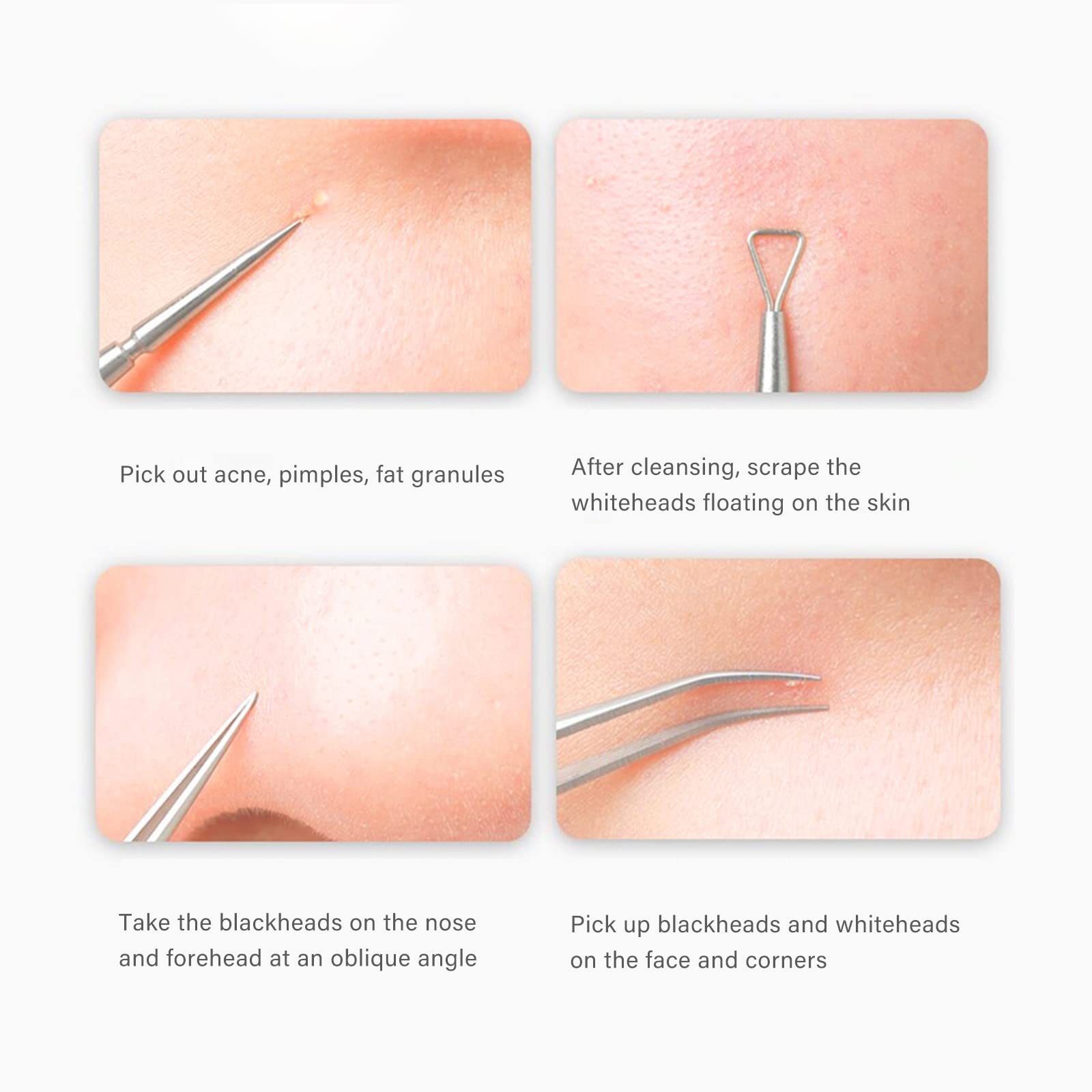 Blackhead Removal Tool, Pimple Popper Extractor Tool Kit, Used for Removing Blackheads, Acne, Comedone, Flaw White Heads on Nose and Face, Professional Stainless Steel Removal Tool.