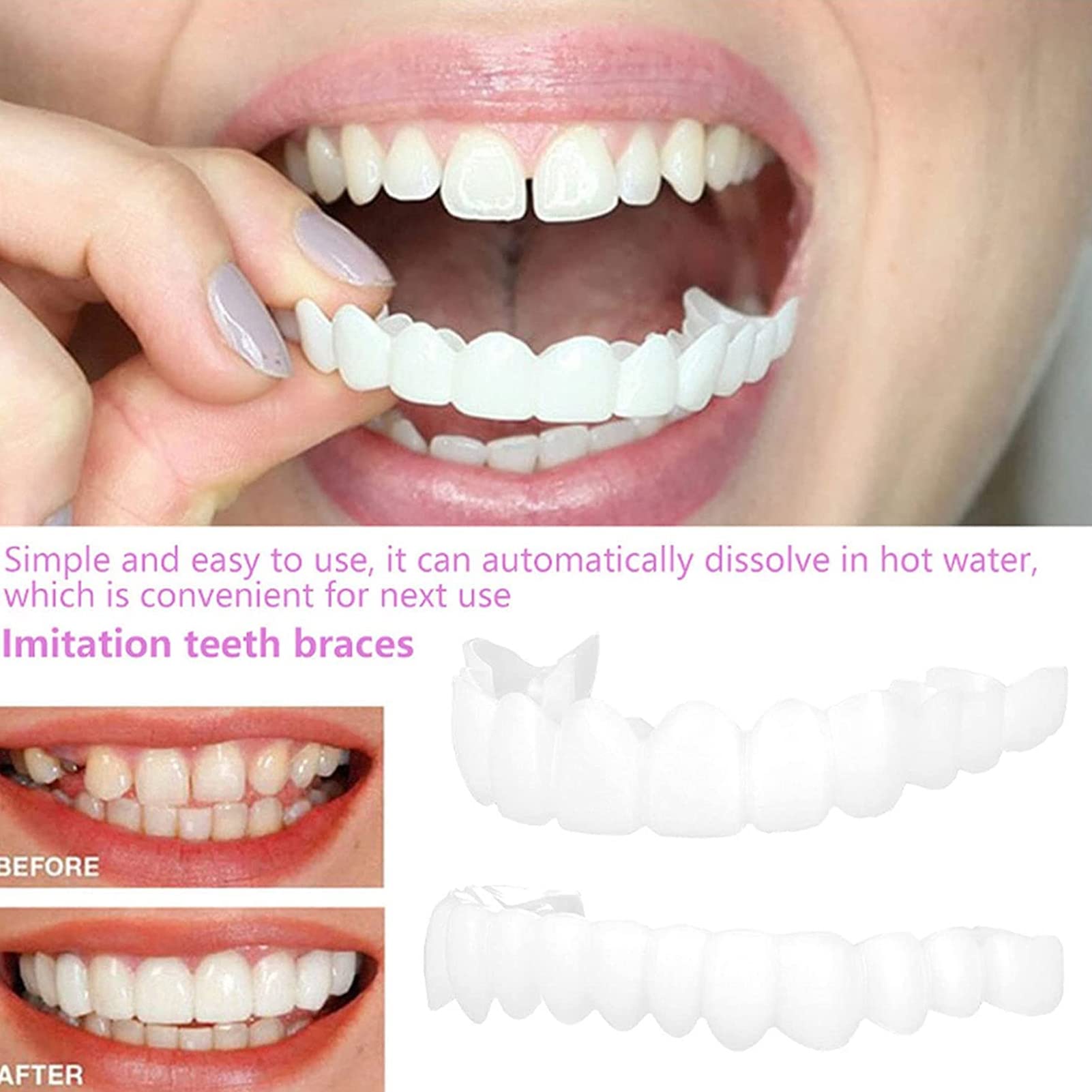 CHJC 2022 New Snap-On Dentures, Veneers Snap in Teeth, Snap in Teeth for Men and Women, Fix Confident Smile, White (CREAM)