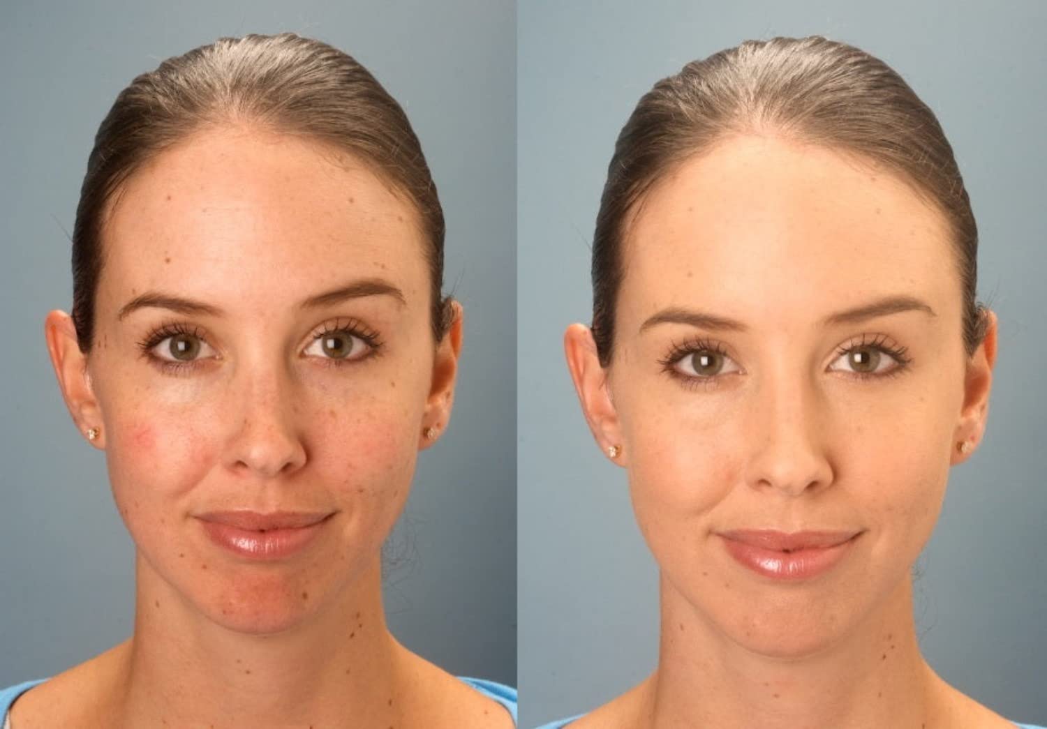 Dr. Denese Advanced SPF 30 Defense Day Cream | BB CREAM | UNIVERSAL SHADE | 2oz |