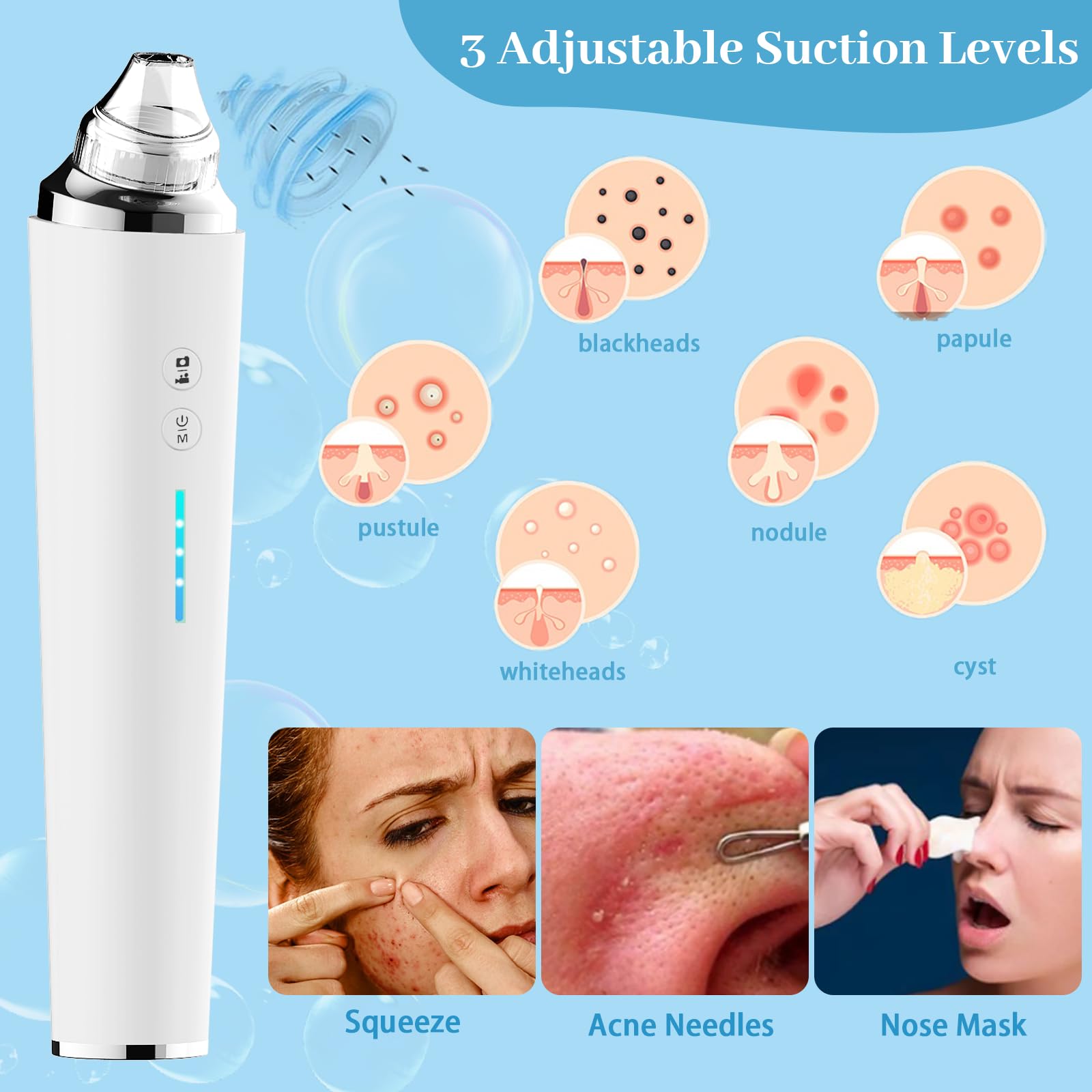 Blackhead Remover Pore Vacuum with Camera, Black Head Remover Suctioner 3 Suction Power & 6 Probes, WiFi Real-Time Skin Screen,Upgraded Pimple Vacuum Acne Comedone Extractor