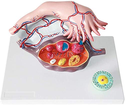 DEAVER Medical Models, Uterine Anatomy Model Ovarian Enlargement Model Skin and Genitourinary System Anatomical Medical Training Aid