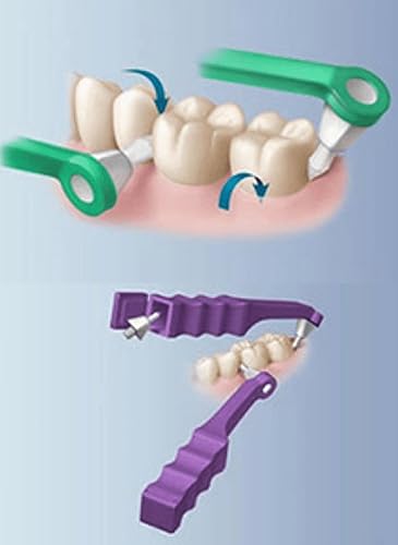 Sulcabrush Replacement Tips