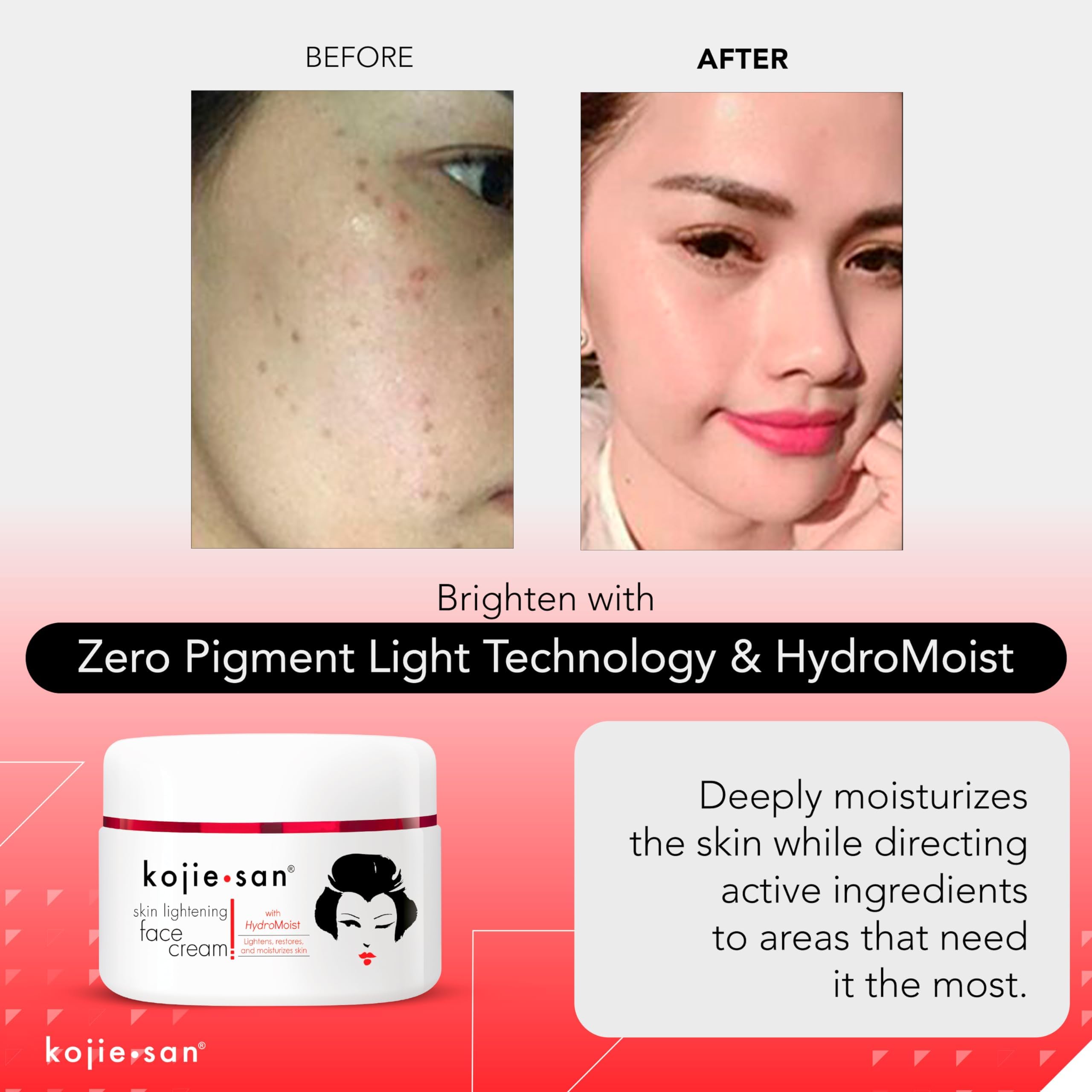 Kojie San Face & Body Complete Brightening Mini Set - 65 Gram x 2 Bars Soap, Body Lotion, Face Cream, and Facial Cleansing Brush