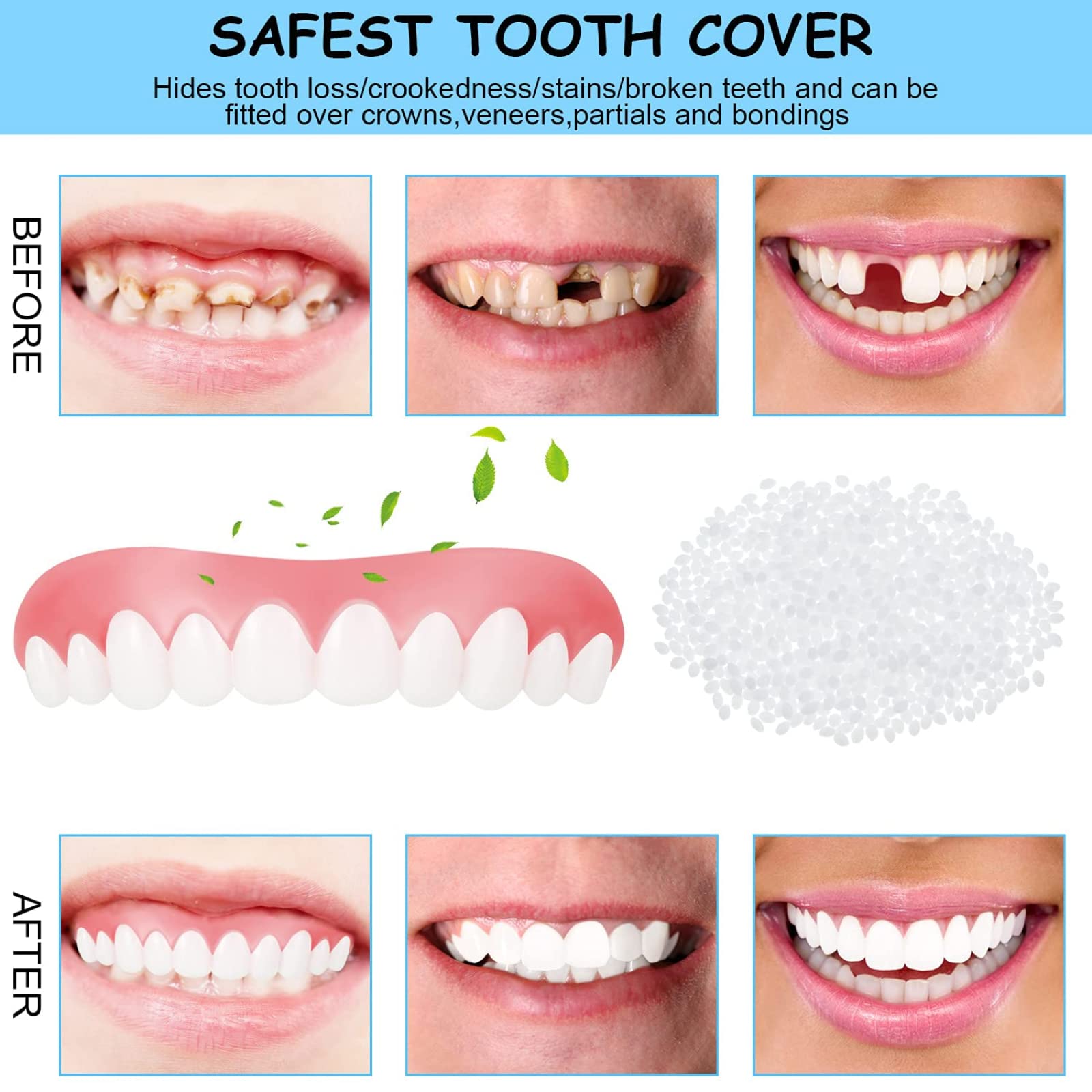 CAILING 4 PCS Professional Temporary Tooth Replacement Kit, Denture Upper & Lower- Instant Veneers for Cosmetic Teeth, Natural Shade Fake Veneer for Temporary Fix Confident Smile 1 1.0 Count