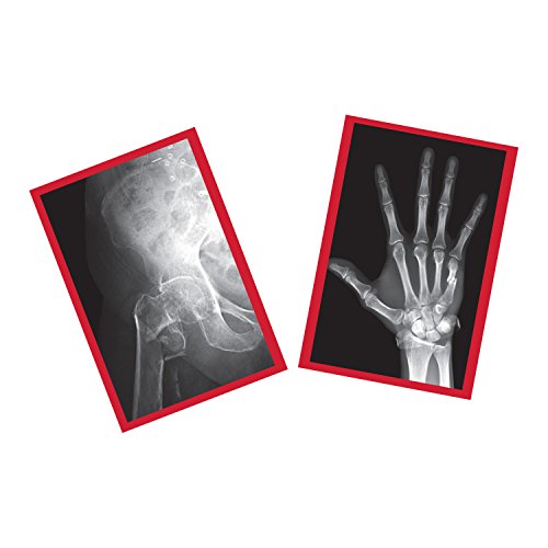 Roylco R-59255 Fixed Bones X-Rays, Black/White, 14 Pieces, Model:R59255