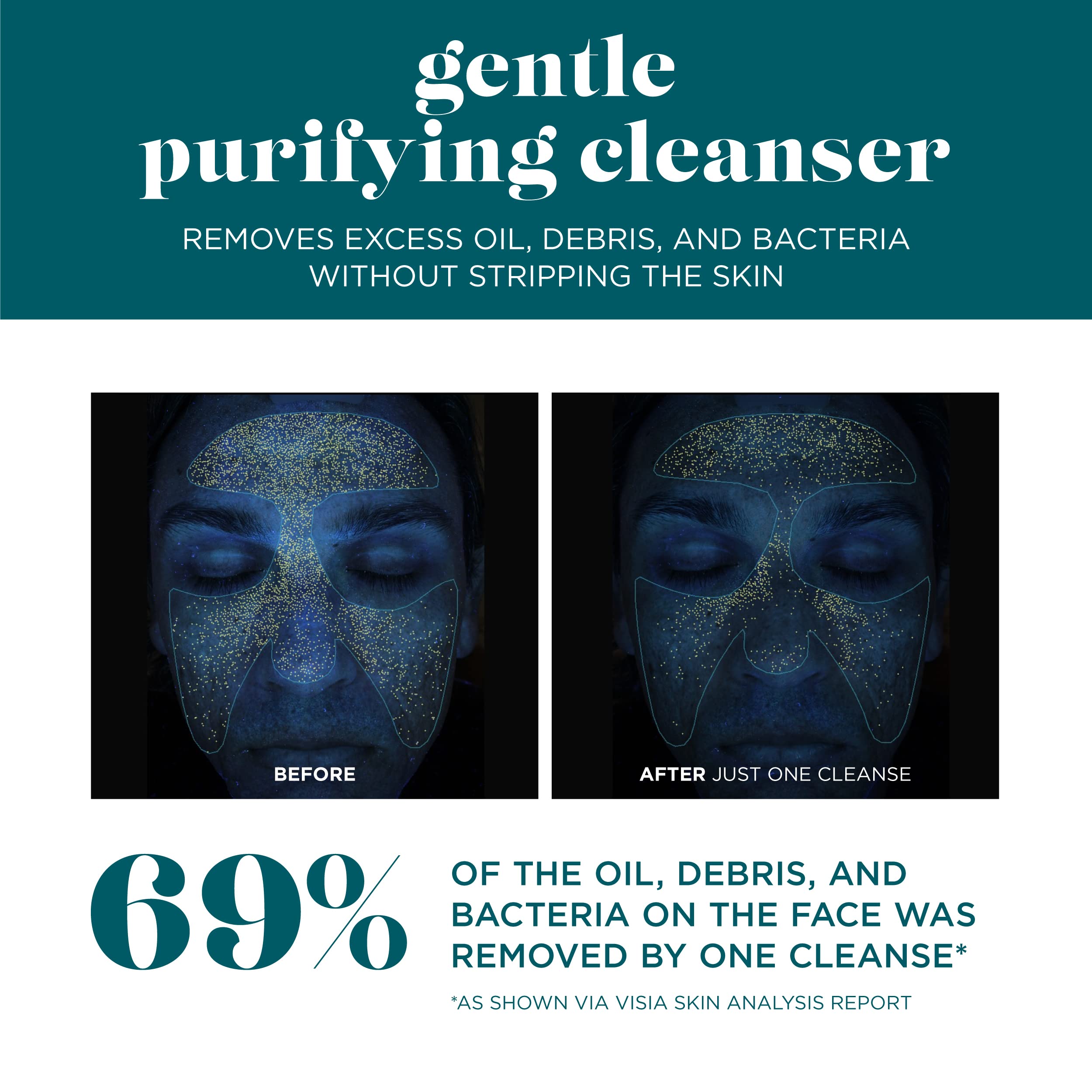 VI Derm Hydrating Gentle Purifying Cleanser, For Daily Use with Aloe Vera, Antioxidants, and Willow Bark Extract, 4 Fl Oz / 120 mL
