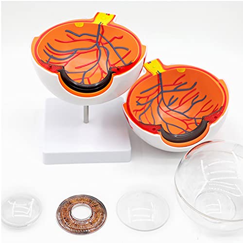 HINGONS 6X Enlarged Human Eye Anatomical Model, Anatomically Eyeball Display Model with Removable Stand for Medical Science Education & Anatomy