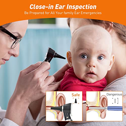 Scian Otoscope - Ear Scope with Light, Ear Infection Detector, Pocket Ear Checker Kit with 3X Magnify Lens & 8 Speculum Tips for Kids,Elders,Dogs,Home Use (Purple)