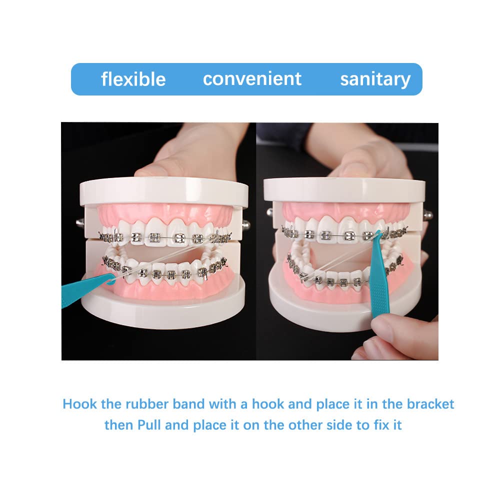 Dental Elastic Rubber Bands Placers for Braces Disposable Plastic Orthodontic Elastic Placers, Personal Orthodontic Supplies, 20Pcs (Placers)