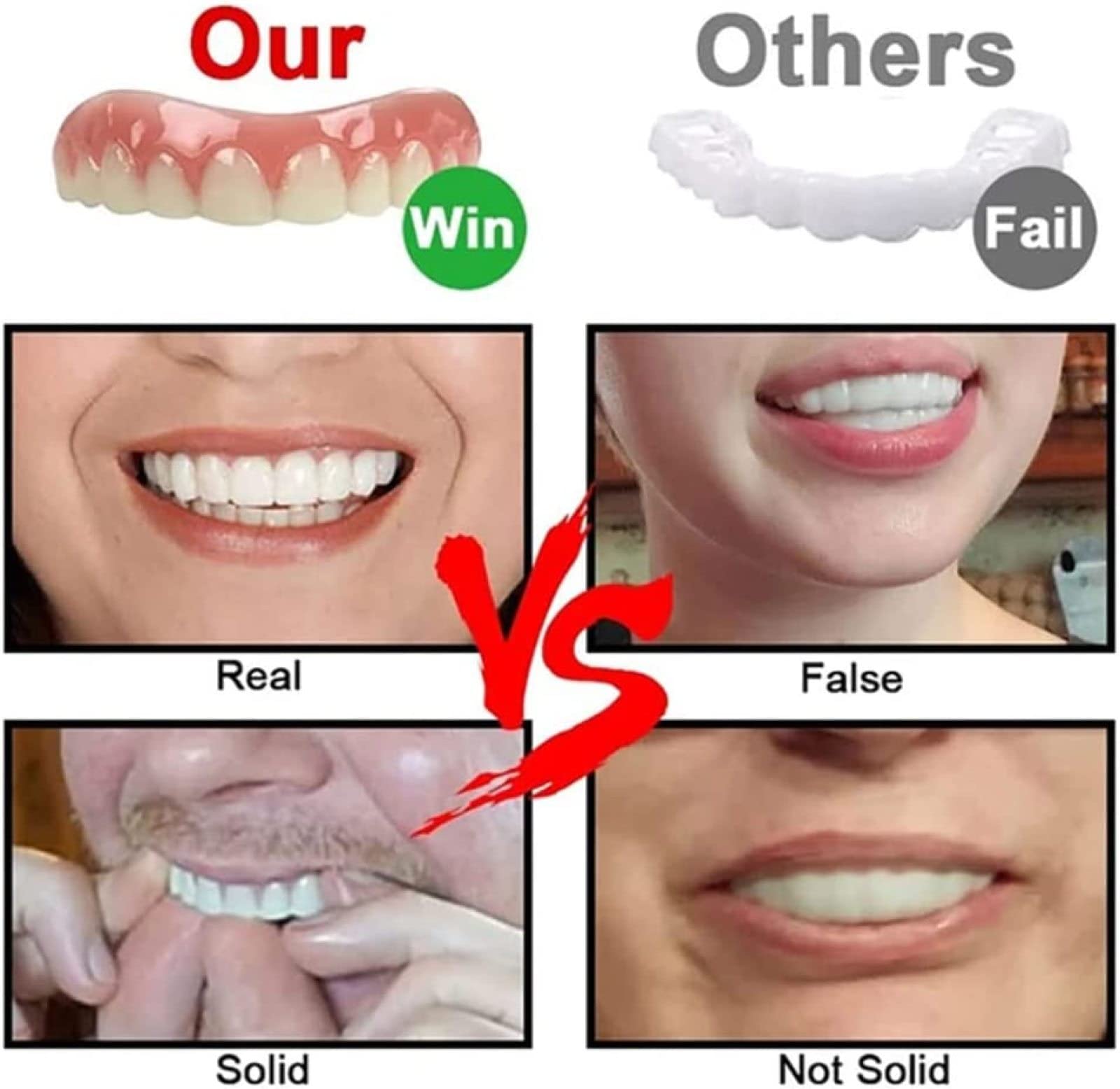 CAILING 4 PCS Professional Temporary Tooth Replacement Kit, Denture Upper & Lower- Instant Veneers for Cosmetic Teeth, Natural Shade Fake Veneer for Temporary Fix Confident Smile 1 1.0 Count