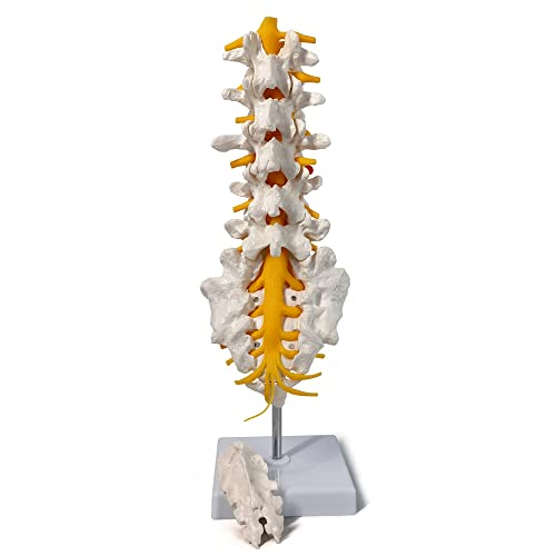 Evotech Lumbar Spine Anatomy Model with Sacrum and Spinal Nerves, Didactic Replica of Lumbrosacral Section with Nerves and A Herniated Disc at L4, Includes Base for Medical Teaching Display
