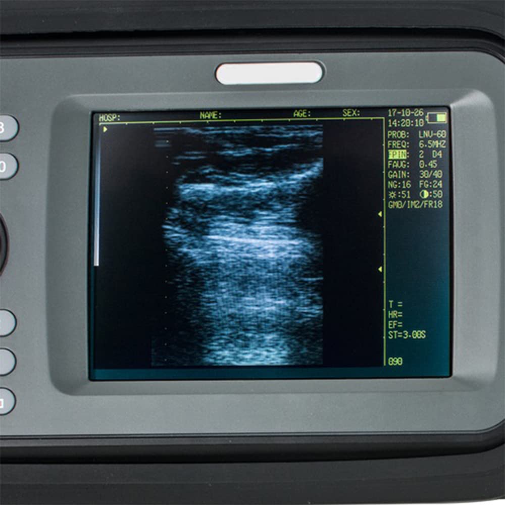 Colilove Veterinary Ultrasound Scanner Handheld Digital Ultrasound Scanner Veterinary Handscan V8 with 4.0MHz Rectal Probe for Pregnancy Check On Farm Animals Cattle/Horse/Camel/Equine/Goat/Cow/Sheep