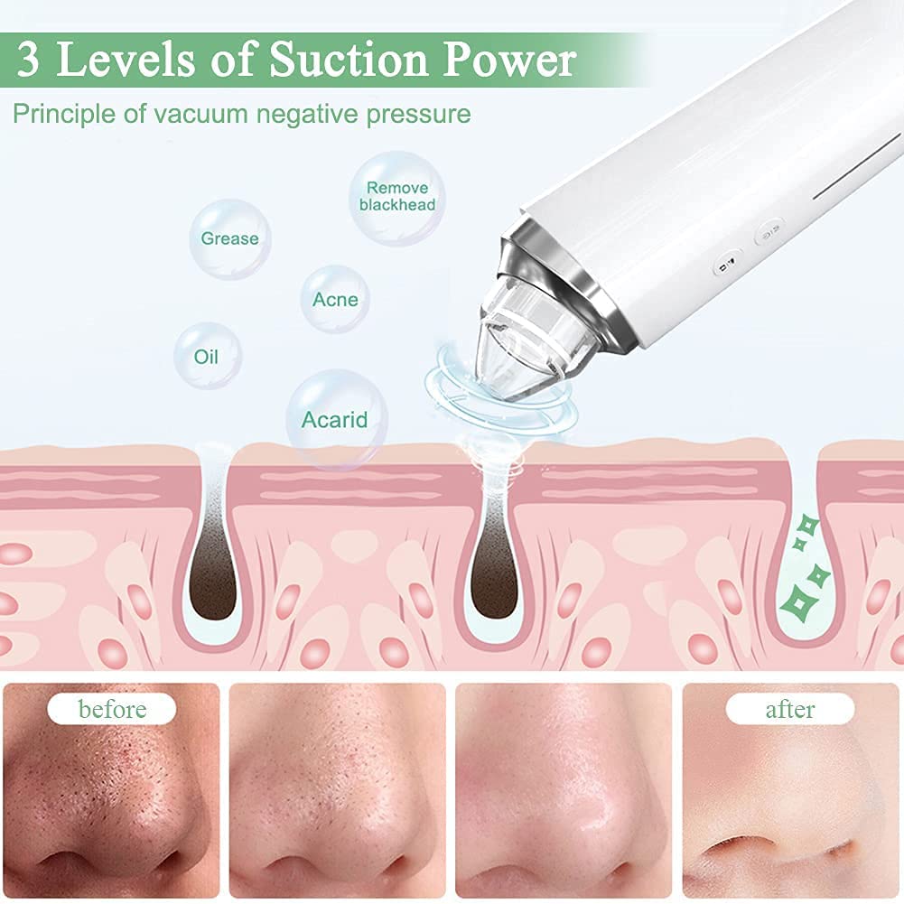 Blackhead Remover Pore Vacuum, 【[FDA Certification] 】WiFi Visible Facial Pore Cleanser with HD Camera Pimple Acne Comedone Extractor Kit with 6 Suction Heads Electric Blackhead Suction Tool