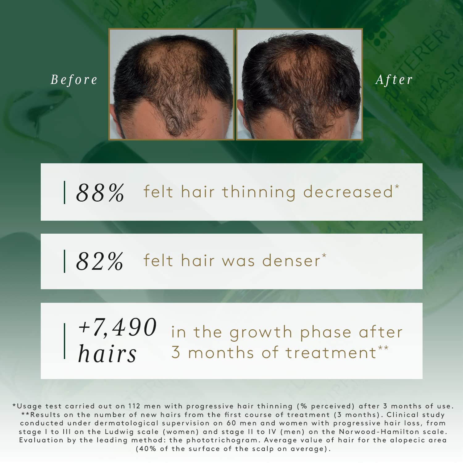 René Furterer TRIPHASIC Progressive Concentrated Serum - Hereditary & Hormonal Thinning Hair - Receding Hairline - Drug-Free - 8 ct., 30-Day Supply