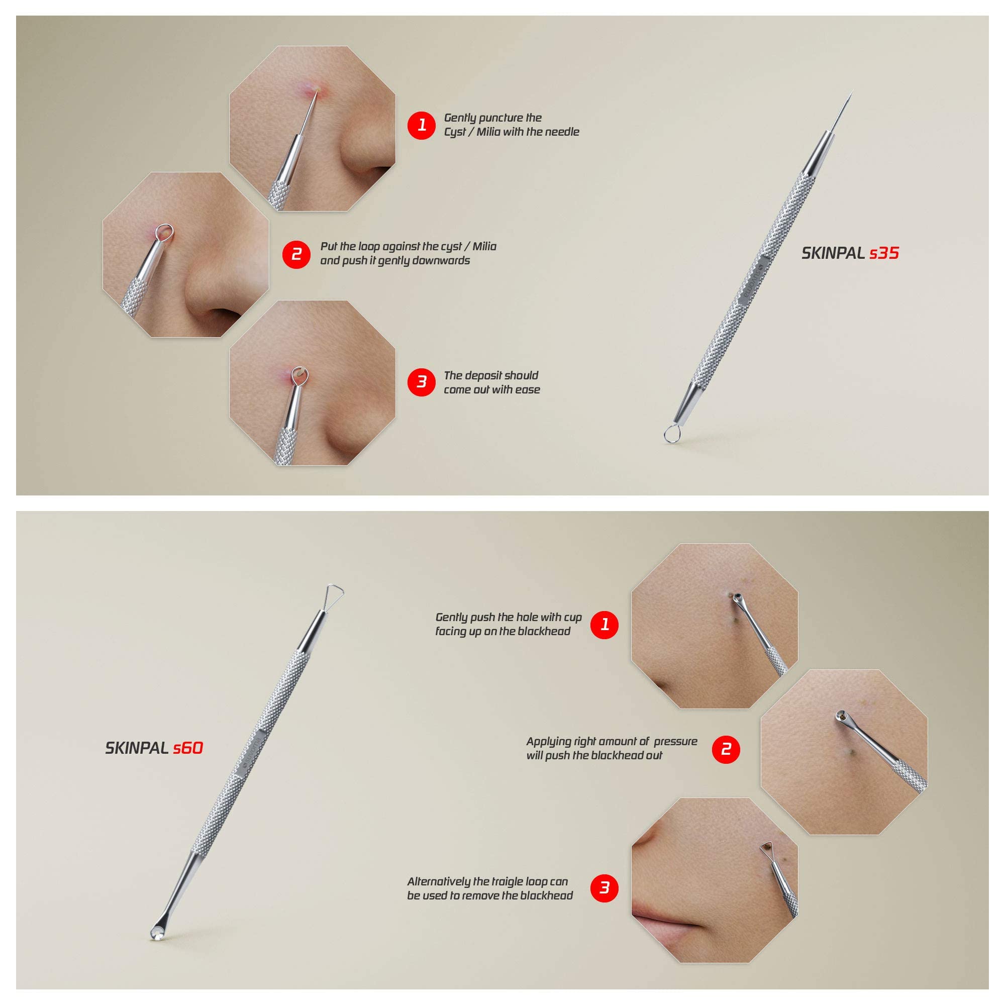 Suvorna Skinpal Pimple Popper Tool Kit | Milia Remover | Lancets for Facial Extraction | Whitehead Extractor Tool | Comedone Extractor | Blackhead Remover Tool | Acne Needle Tool & Cyst Removal Tool.