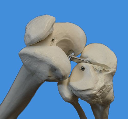 Wellden Medical Anatomical Human Lower Limb Skeleton Model, Life Size
