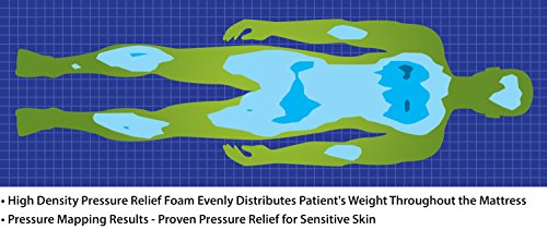 Kolbs NSR Long Term Care Pressure Redistribution Foam Mattress
