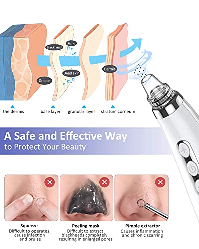 Blackhead Remover Pore Vacuum - Upgraded Strong Suction Electric Pore Cleanser Beauty Device for Deep Facial Skin Cleaning - 5 Adjustable Suction, 6 Different Replacement Probes, USB Rechargeable