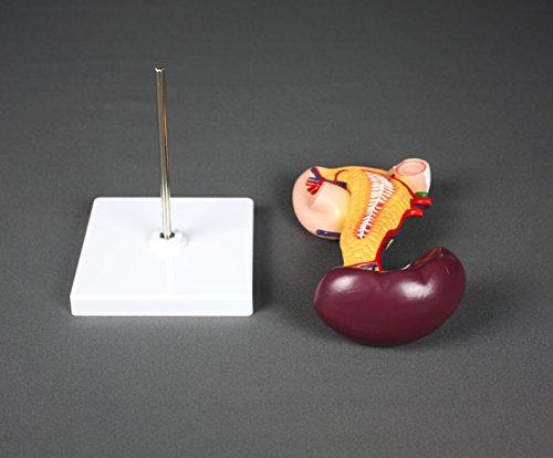 Vision Scientific VAD423-N Pancreas, Duodenum, & Spleen Model