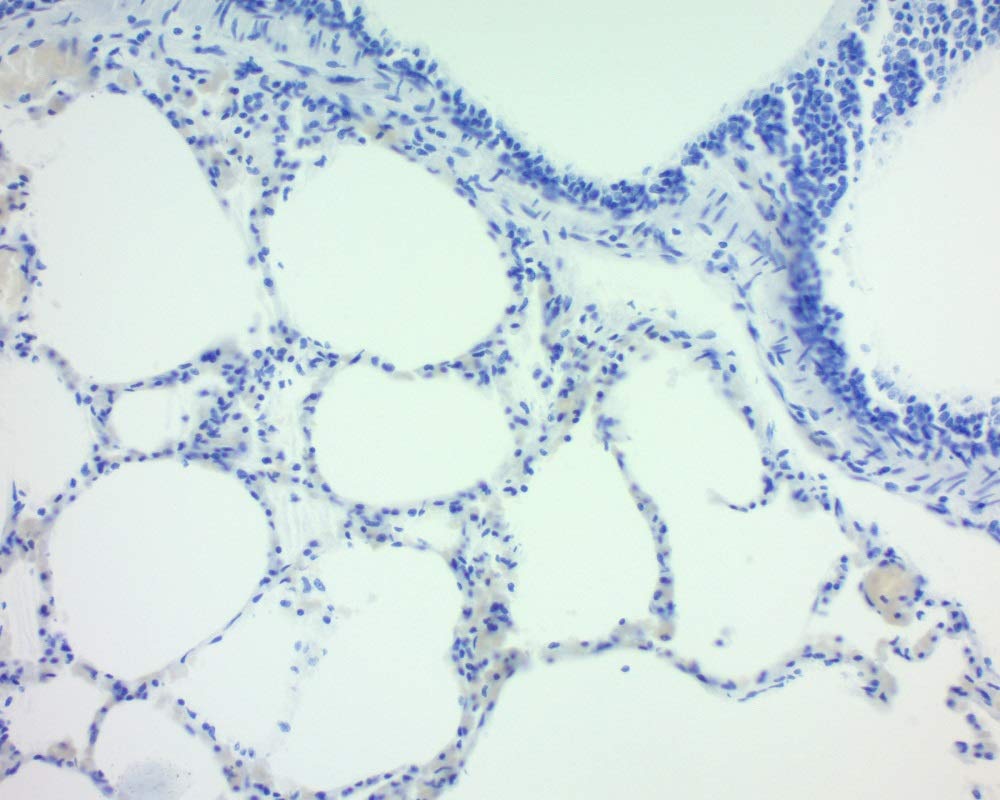 Hematoxylin, Mayer's (Lillie's Modification), 1 Gallon