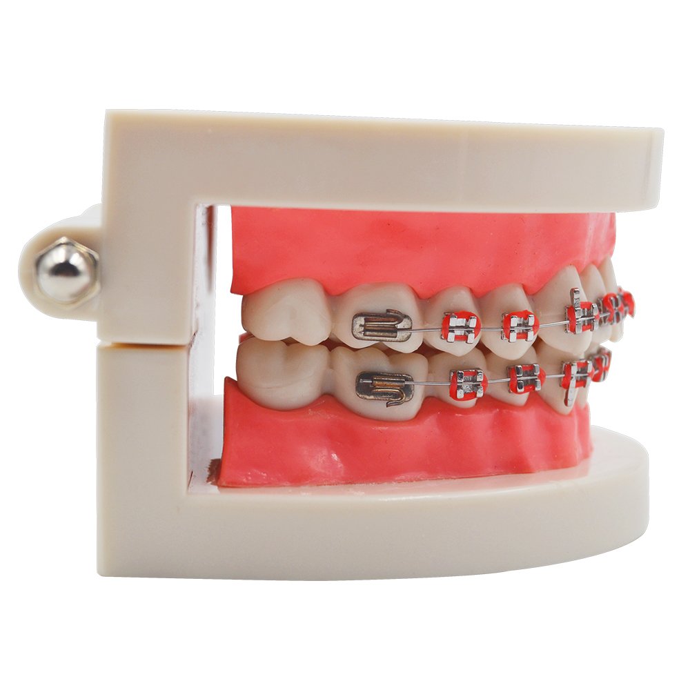 COSPNT Orthodontic Treatment Model Standard Teaching Model Study Teeth Educational Demonstration Tool Student forTeaching All Metal Brackets