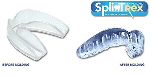 SplinTrex Multi Use Teeth Mouth Guards - 4 Pack - BPA Free - Teeth Grinding Dental Night Guard, Athletic Mouth Guard, Teeth Whitening Tray - Includes 4 Customizable Mouth Guards and Storage Case