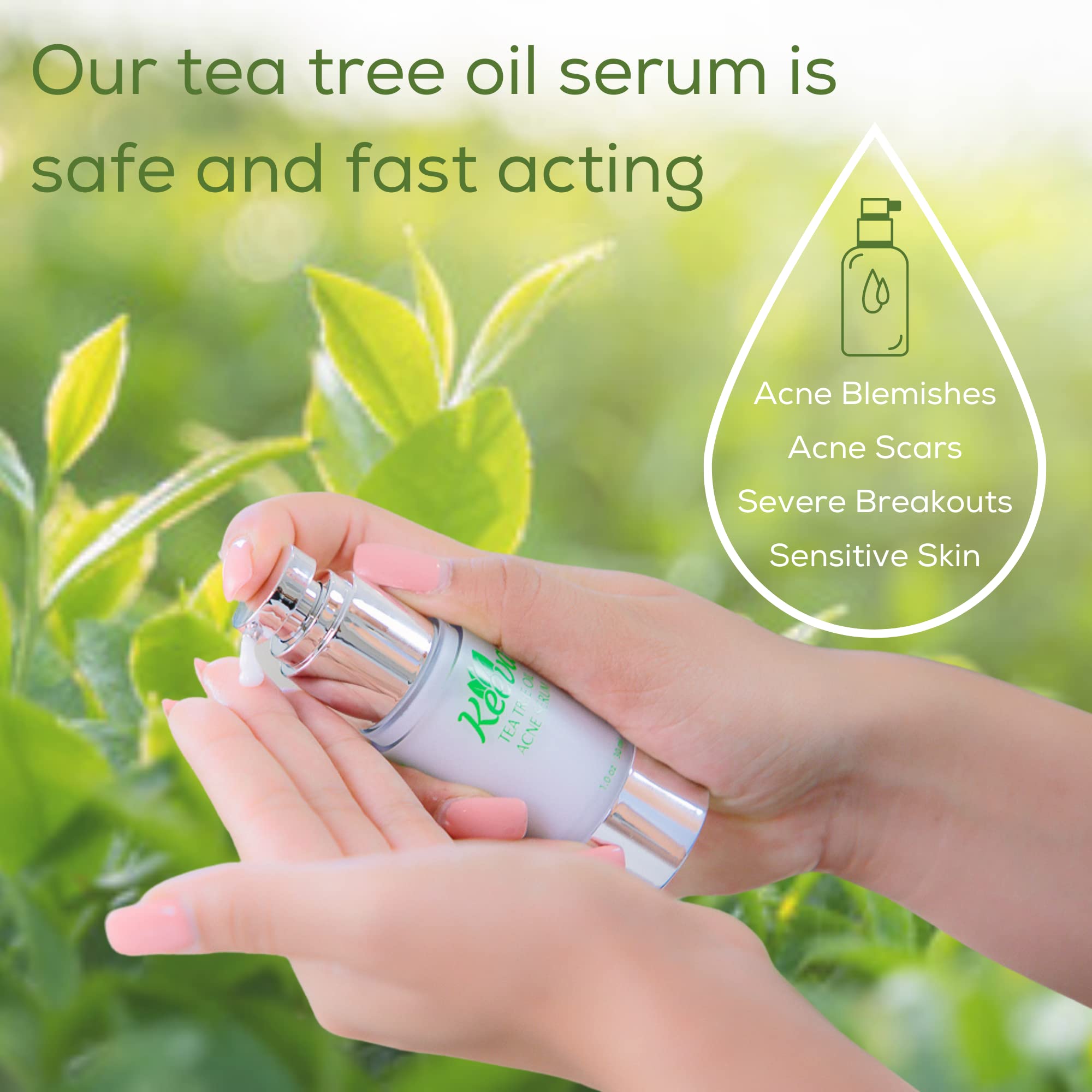 Tea Tree Oil Acne Serum - Perfect for Blemishes, Spots, Scars, Bacne, Pimples, Blackheads, Whiteheads with Natural & Organic Ingredients - by Keeva Organics