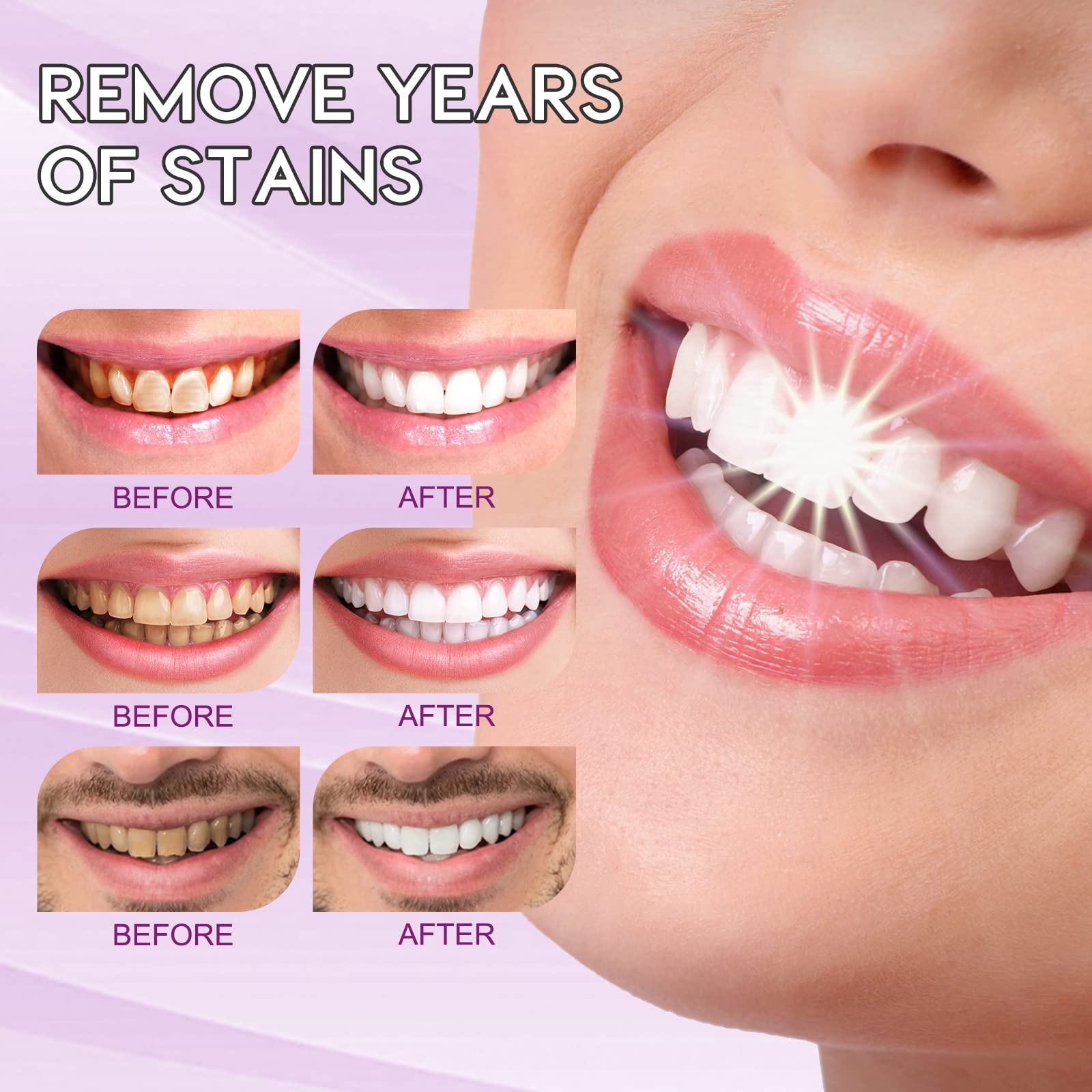 Corrector Whitening Toothpaste,Purple Toothpaste for Teeth Whitening Sensitive Teeth,Tooth Stain Removal, Teeth Whitening Booster,Not Causing Sensitivity