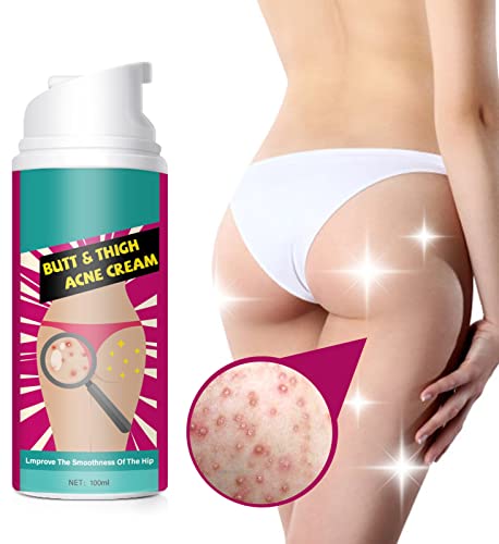 Buttocks And Legs Removal And Printing Tighten Skin Hips Smoothing Moisturizing Face Moisturizer for Oily Skin (White, One Size)