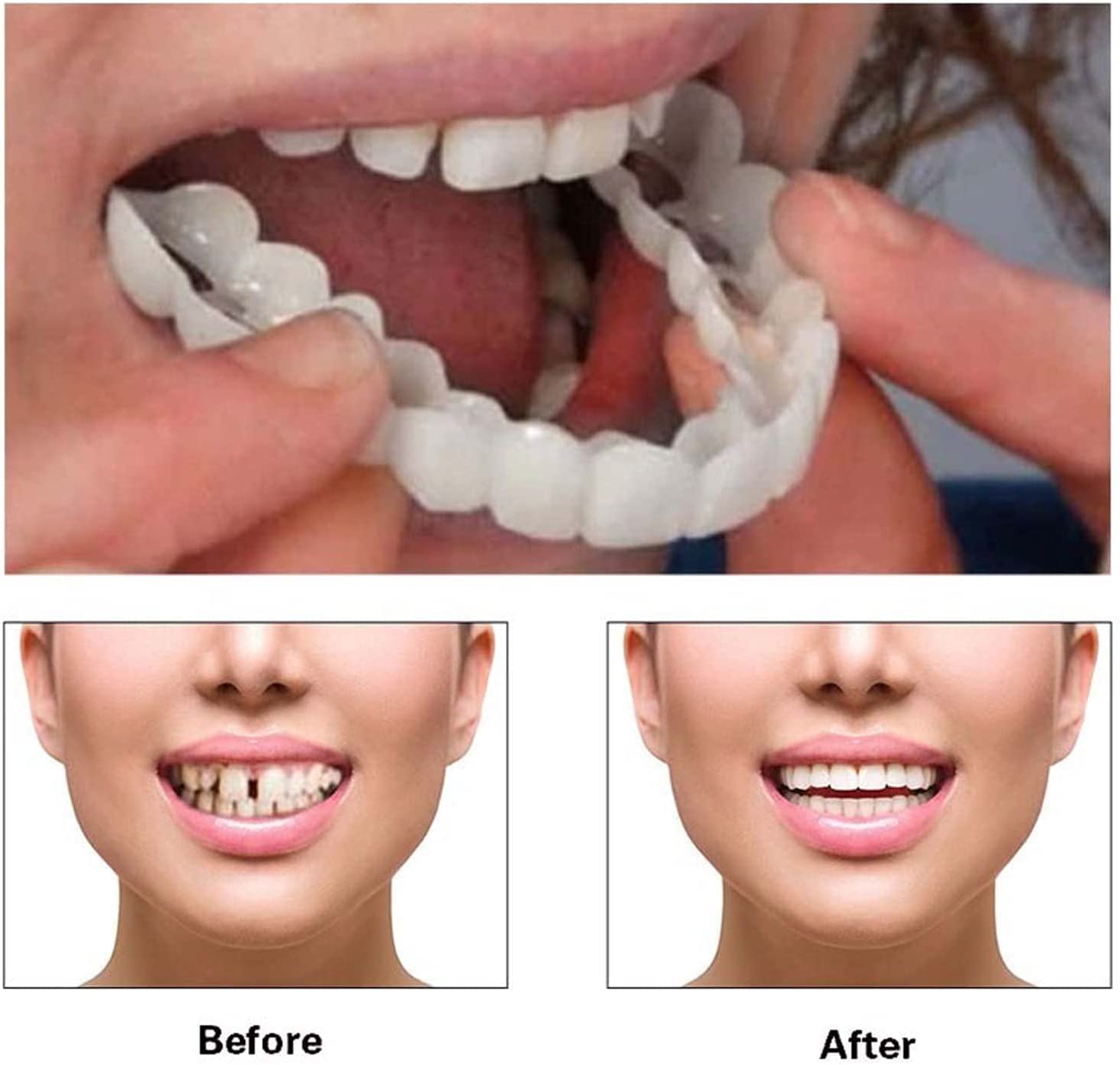 daliwan Dentures Veneers Fake White Teeth with Teeth, Veneers Dentures Socket for Women and Men, Dental Veneers for Temporary Tooth Repair, 2.0 Count