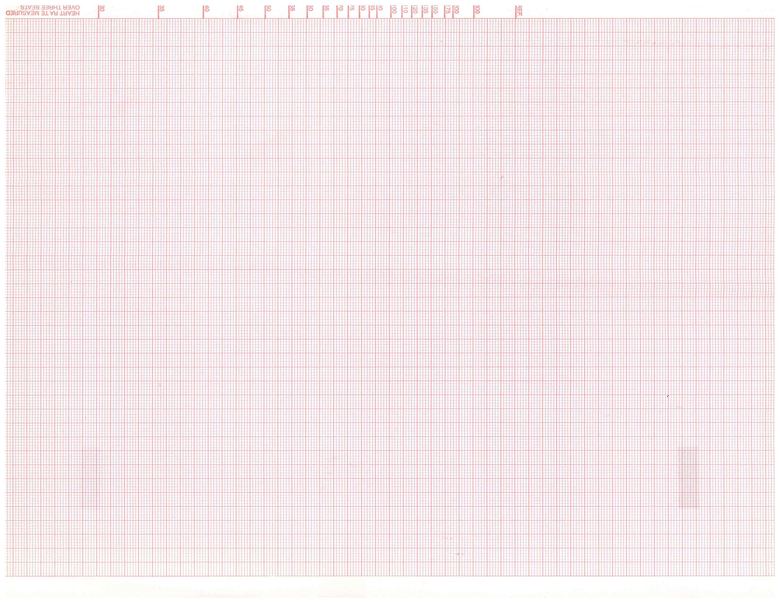 ECG/EKG Paper for Mortara ELI 200-215mm X 280mm, Z-fold (10 Packs/Box)