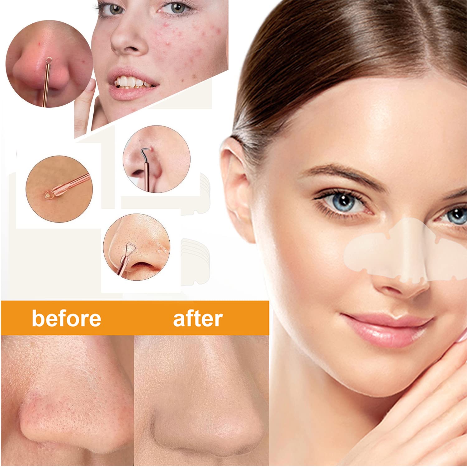 Blackhead Remover 16pcs Kit with Portable Box