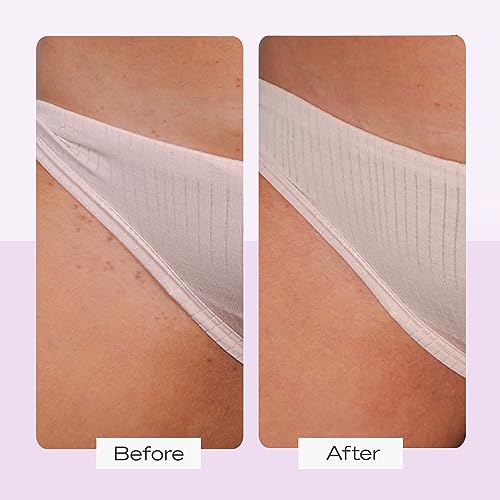 First Aid Beauty Ingrown Hair Pads with BHA & AHA β Daily Treatment Prevents Razor Bumps + Ingrown Hairs and Soothes Irritation β 28 Pads